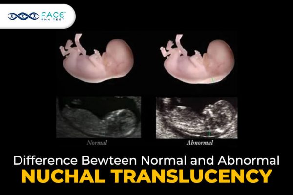 Difference Between Normal and Abnormal Nuchal Translucency